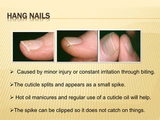 Nail Fold Infarcts