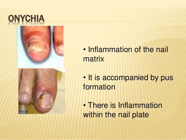 Applied aspects of nail