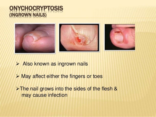 Applied aspects of nail