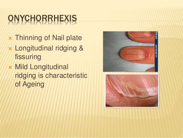 Applied aspects of nail