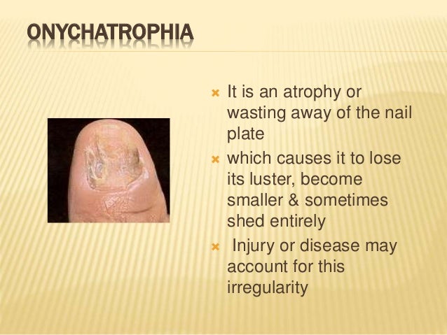 Applied aspects of nail