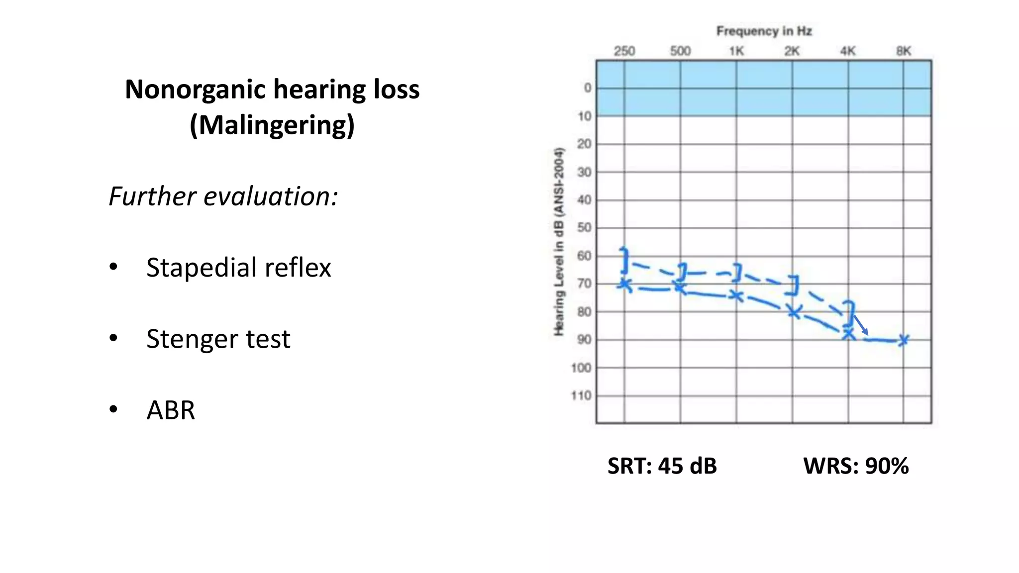 Applied audiometry | PPTX