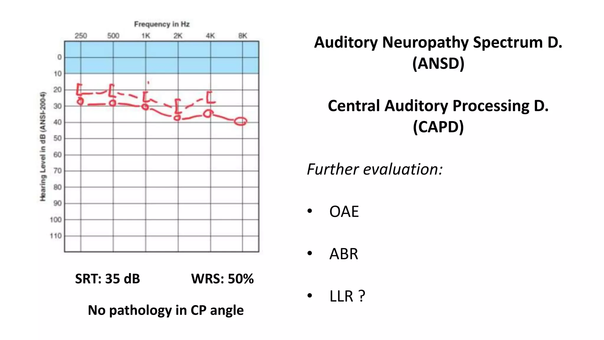 Applied audiometry | PPTX