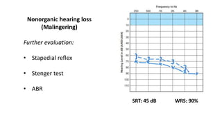 Applied audiometry | PPTX