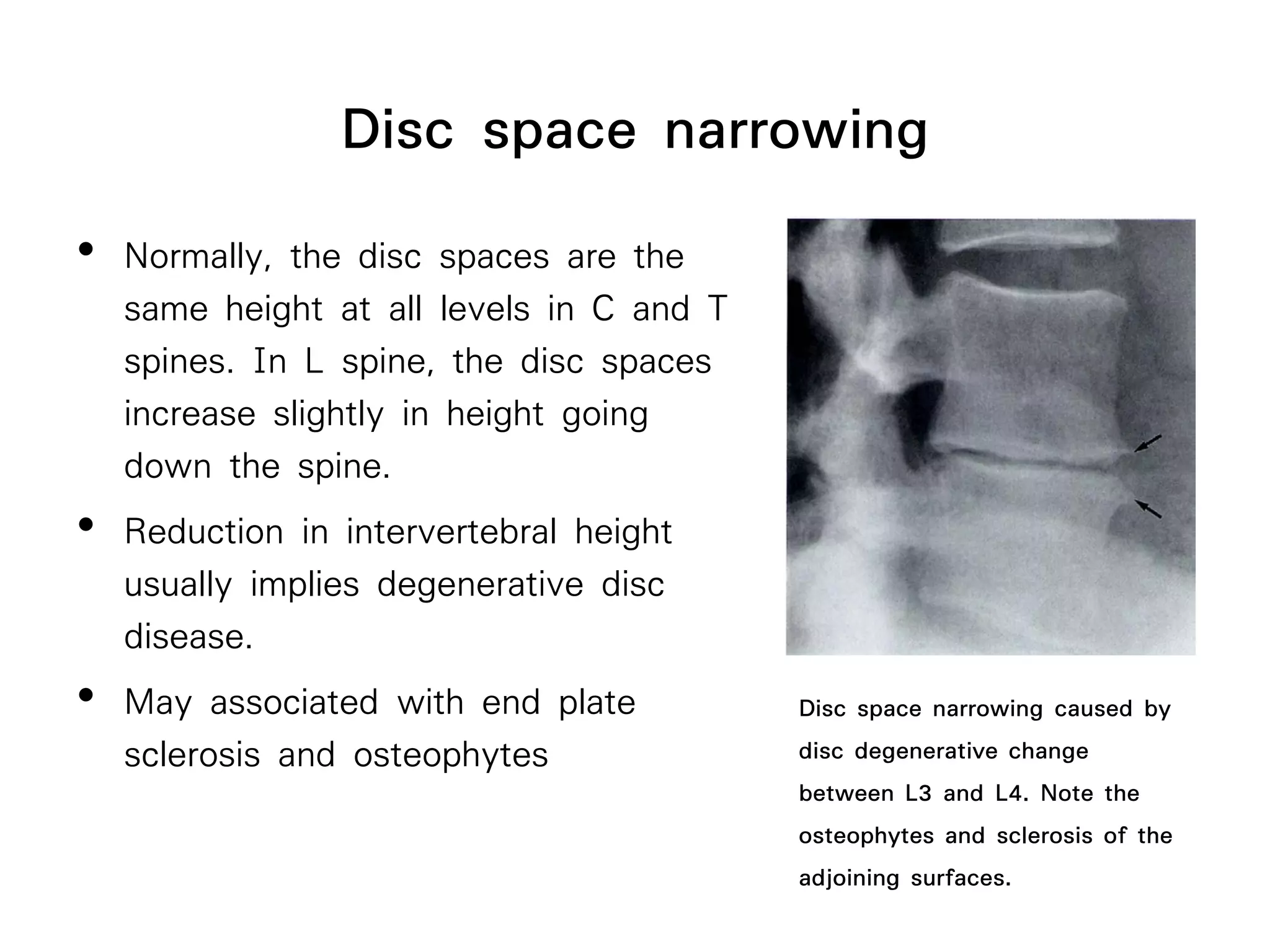 Applied cross sectional anatomy of spinal cord | PDF