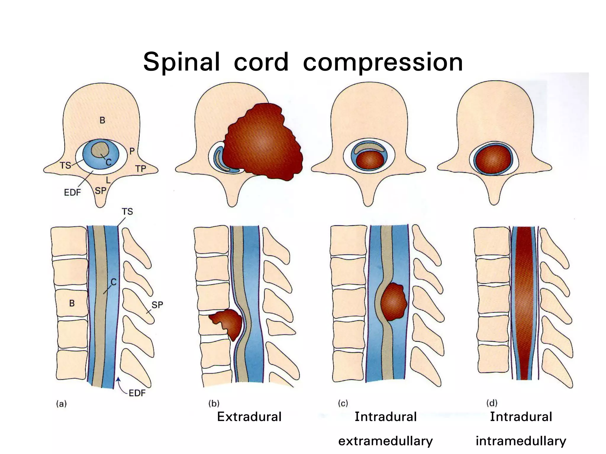 Applied cross sectional anatomy of spinal cord | PDF