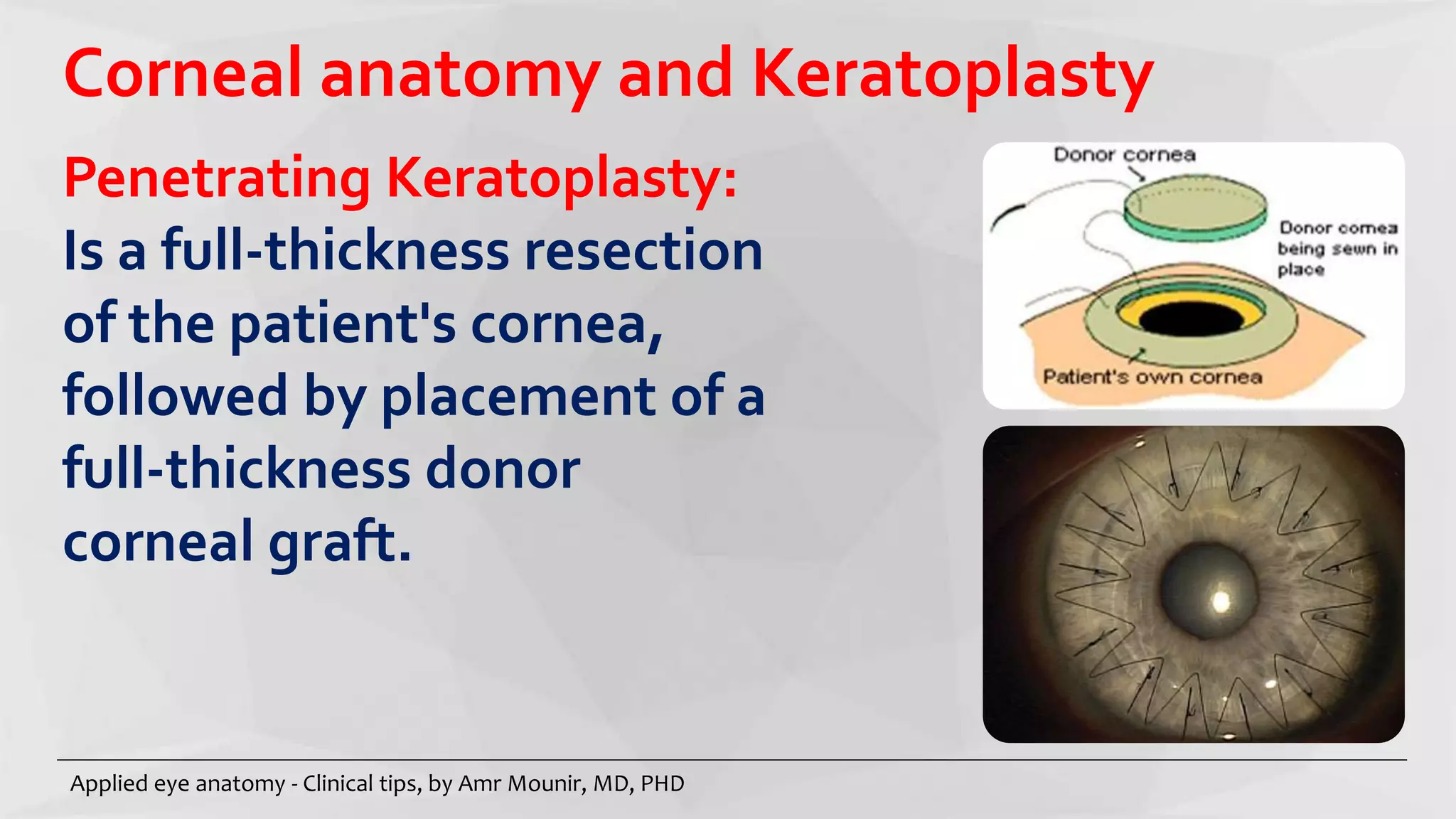 Applied eye anatomy...clinical tips | PPTX