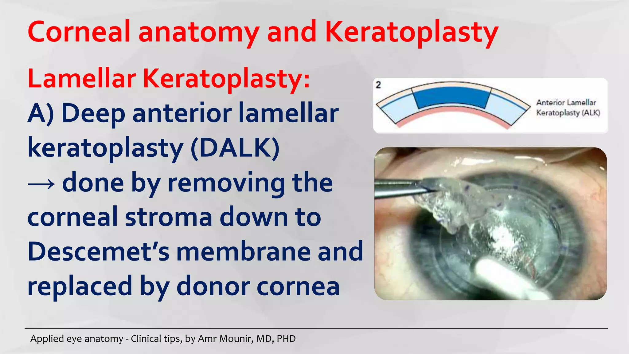Applied eye anatomy...clinical tips | PPTX