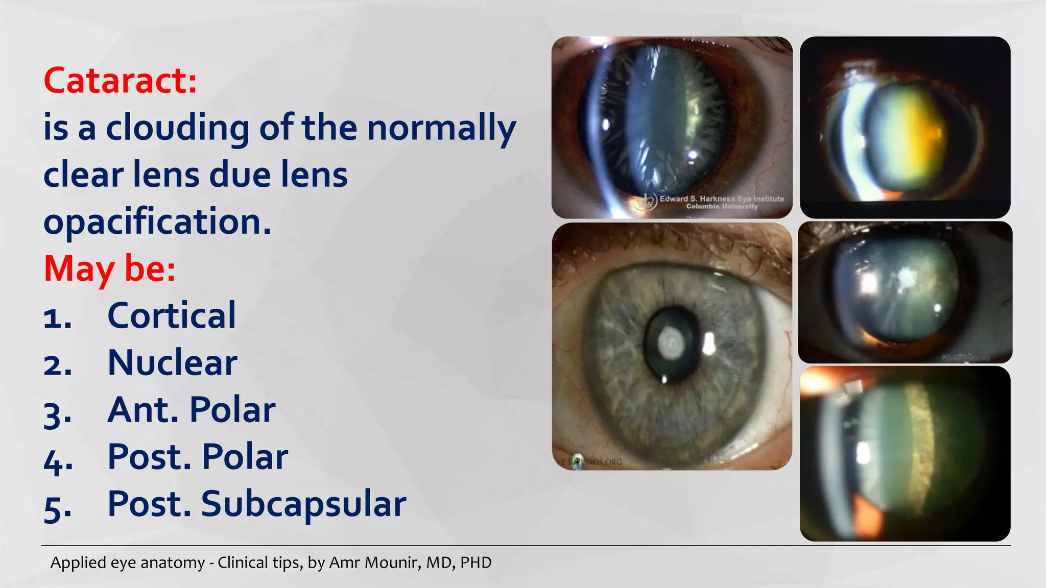 Applied eye anatomy...clinical tips | PPTX