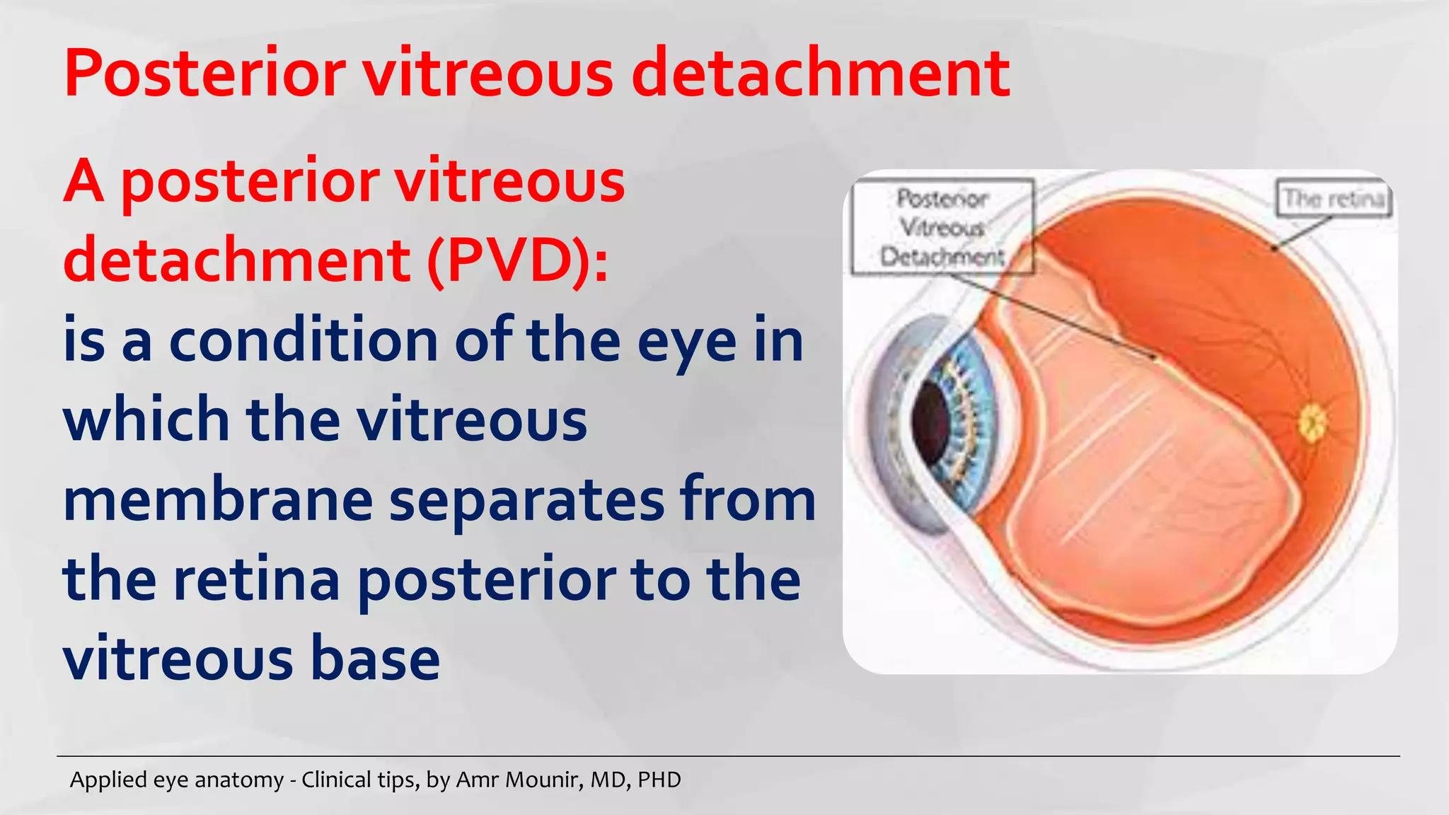 Applied eye anatomy...clinical tips | PPTX