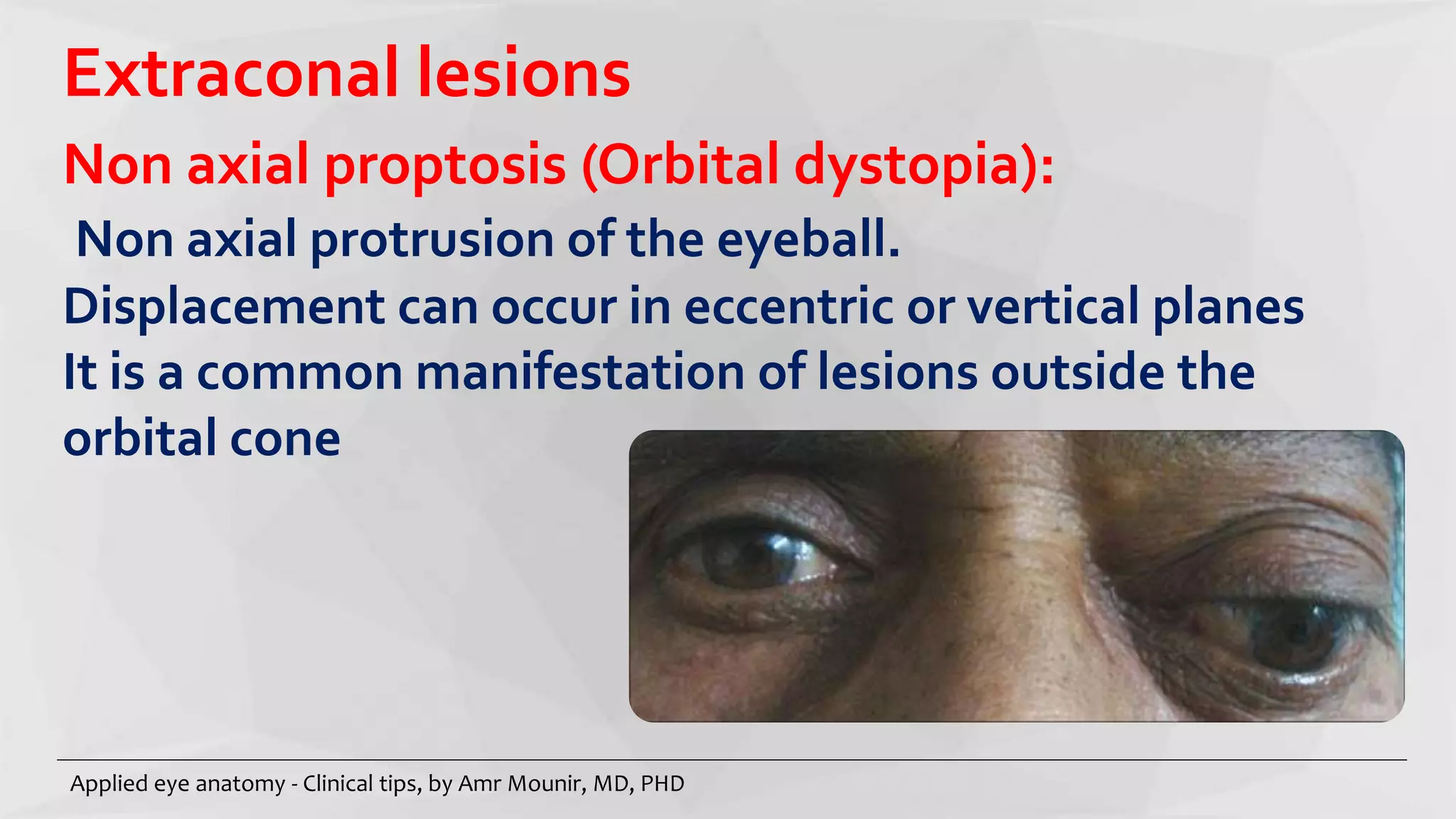 Applied eye anatomy...clinical tips | PPTX