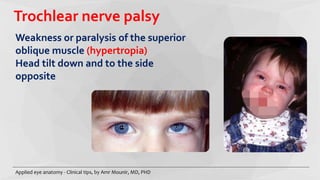 Applied eye anatomy...clinical tips | PPTX