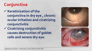 Applied eye anatomy...clinical tips | PPTX