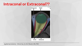 Applied eye anatomy...clinical tips | PPTX