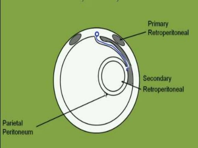 Applied radiological anatomy of retroperitoneum and peritoneal spaces ...