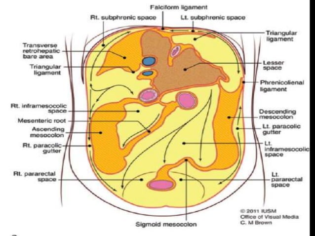 Applied radiological anatomy of retroperitoneum and peritoneal spaces ...