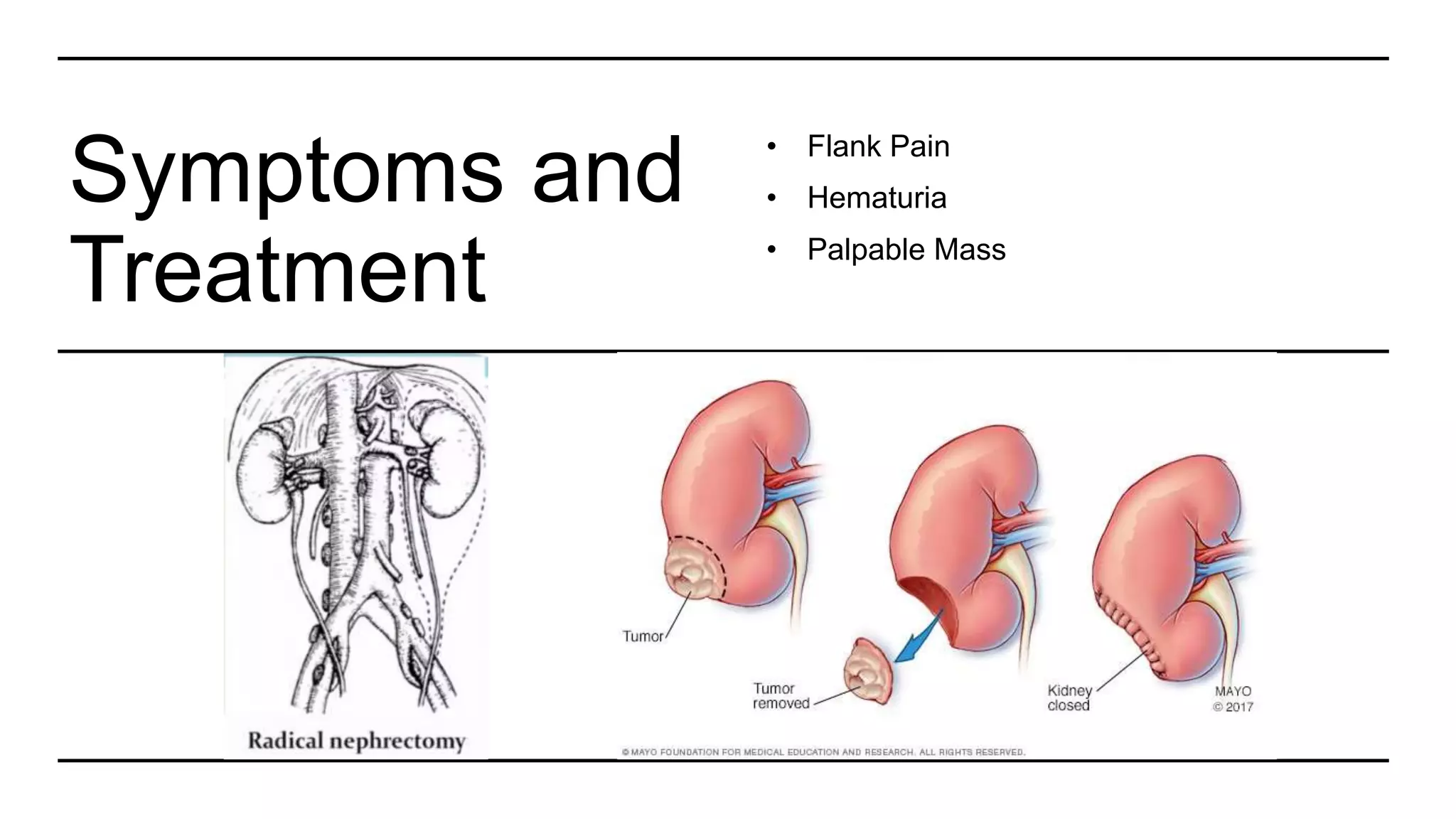 Applying Deep Learning Techniques in Automated Analysis of CT scan images for the Detection and ...
