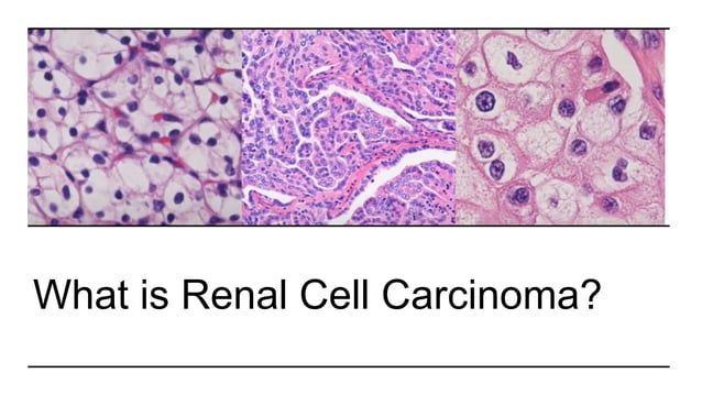 Applying Deep Learning Techniques in Automated Analysis of CT scan images for the Detection and ...