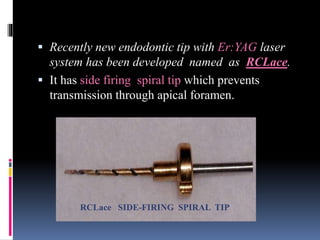 Applications of lasers in endodontics | PPTX