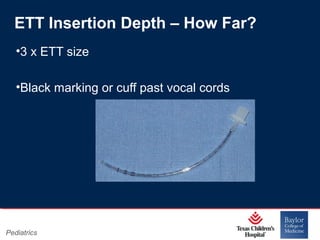 App ped aw eti | PPT