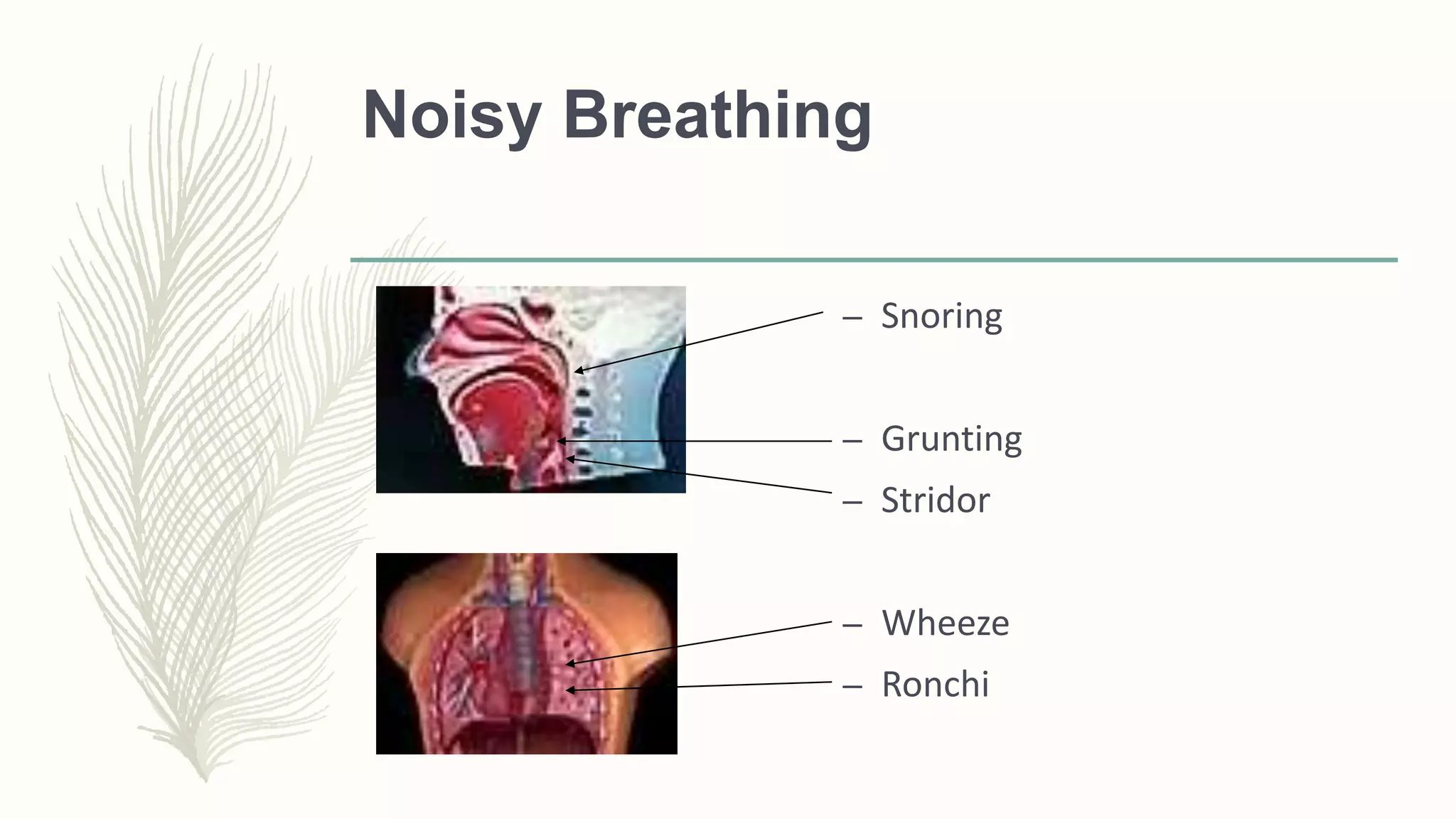 Approach to respiratory distress in children | PPTX