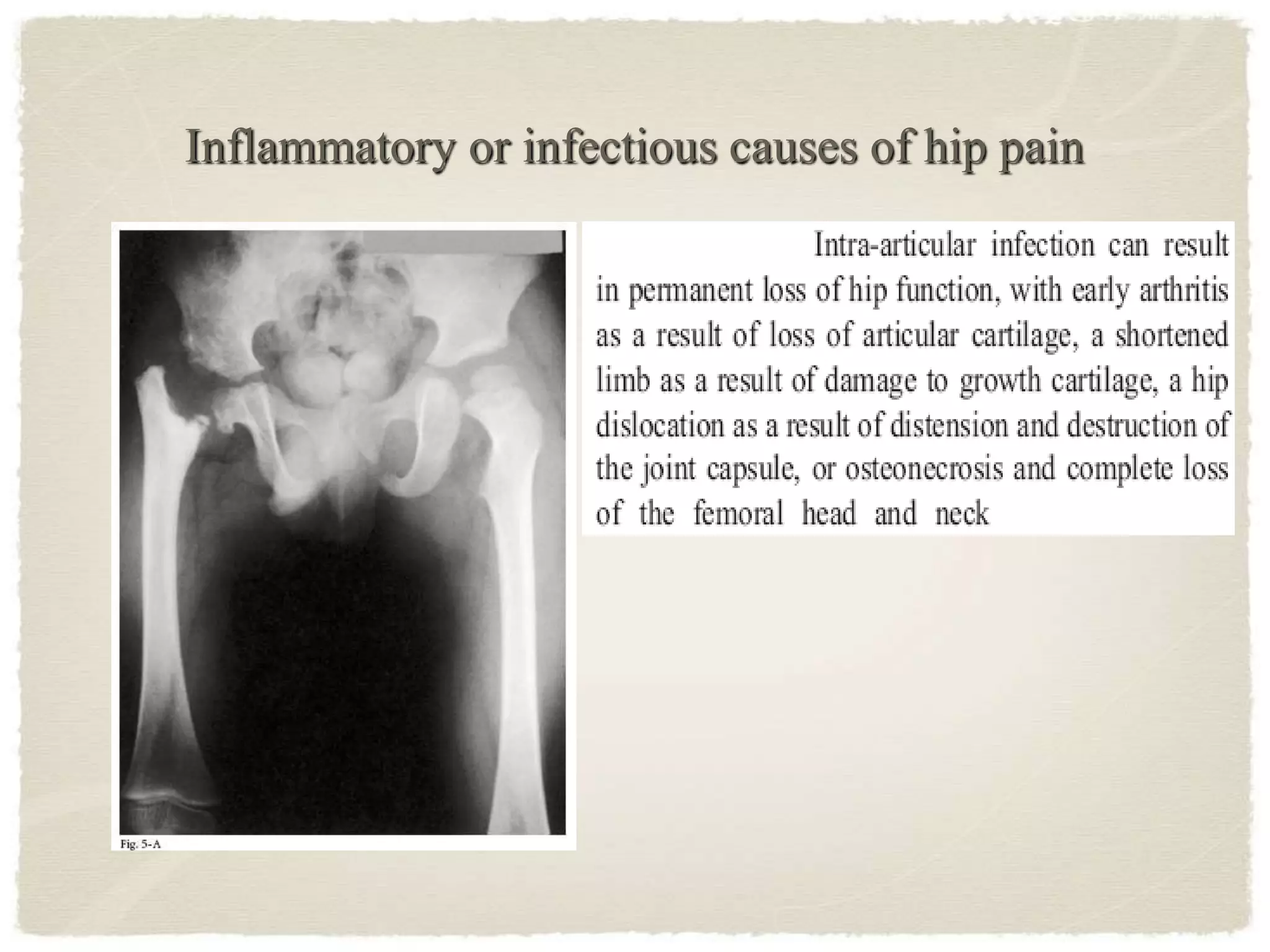 Appraoch to child with hip pain | PPT