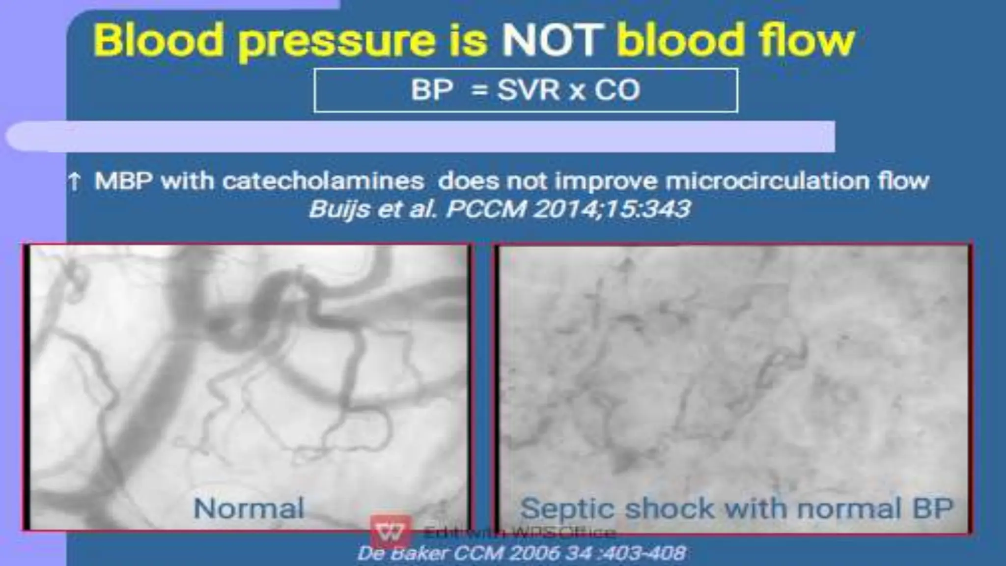 APPRECIATING INOTROPES.pptx | Heart and Cardiovascular Diseases ...