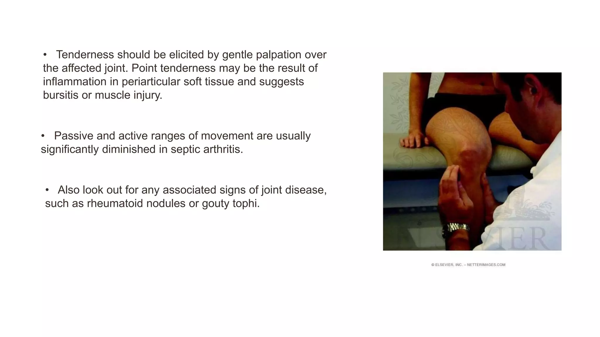 ATRAUMATIC JOINT SWELLING | PPTX
