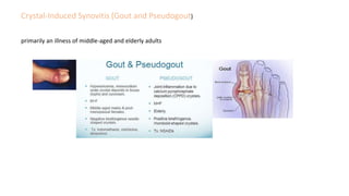 ATRAUMATIC JOINT SWELLING | PPTX