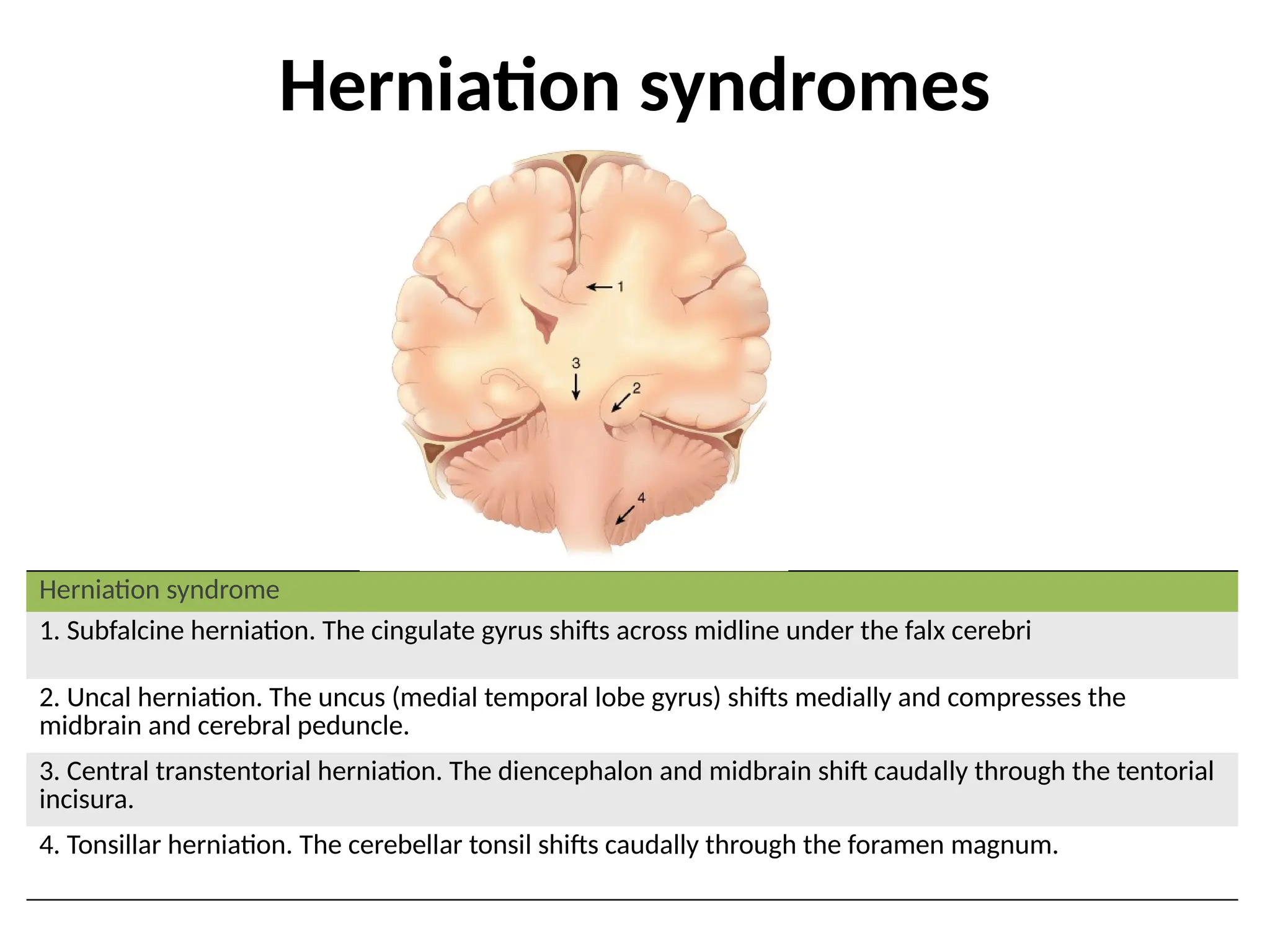 Approach coma coma coma approach coma.pptx