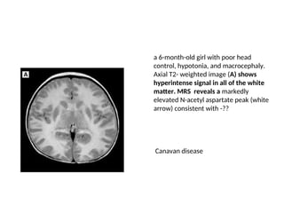 approach-ppt.ppt123456789000000000000000 | PPT