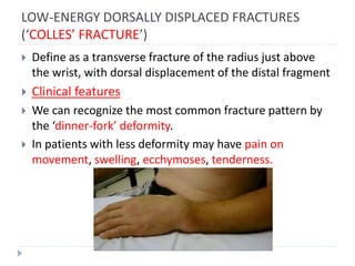 approach-to-fractures-managment-in-elderly-1-_1_.ppt