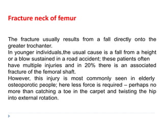 approach-to-fractures-managment-in-elderly-1-_1_.ppt