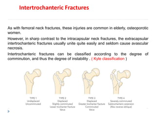 approach-to-fractures-managment-in-elderly-1-_1_.ppt