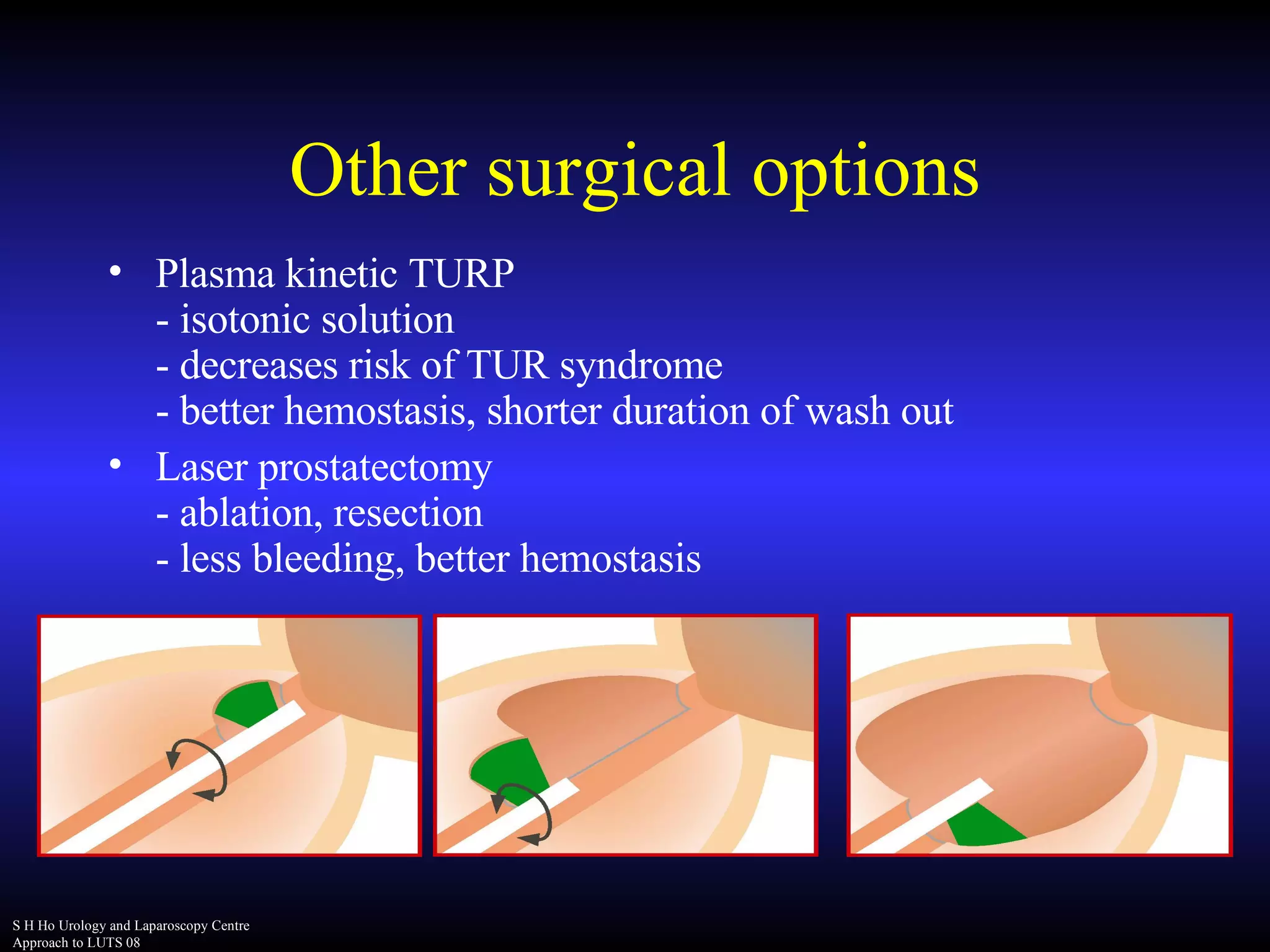 Family Physician's Approach to Lower Urinary Tract Symptoms | PPT