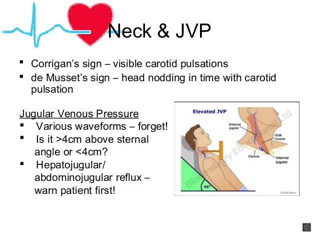Approach to the cardiovascular examination