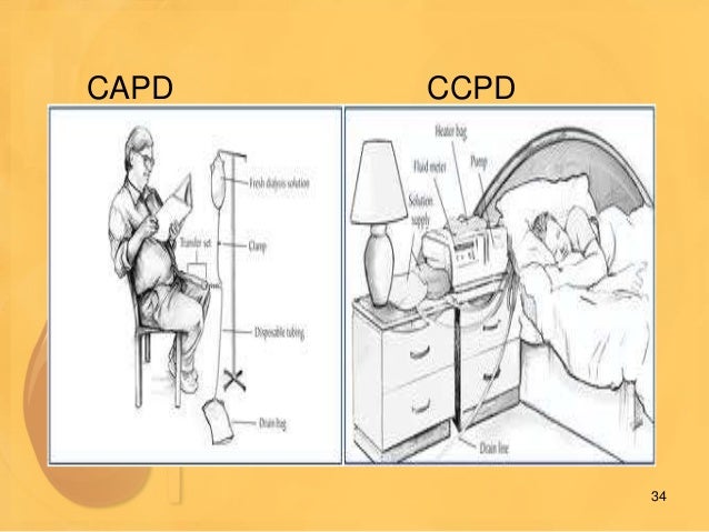 Approach and management of chronic kidney disease sandeep