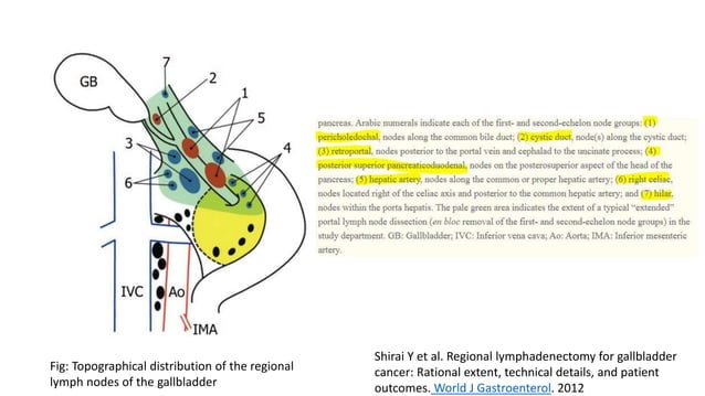 Approach and management of incidental carcinoma gallbladder | PPTX ...