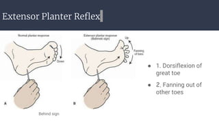 Approach A Patient With STROKE for beginnerspptx | PPTX