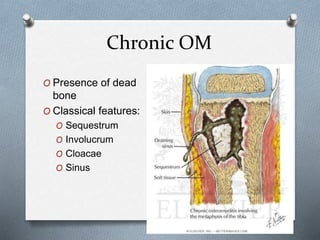 Approach & classification of osteomyelitis | PPTX