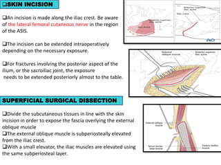 APPROACHES OF ILIUM, PUBIC SYMPHYSIS & SACROILLIAC JOINT | PPT