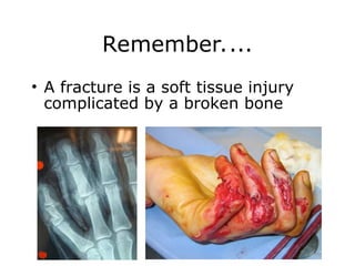 Hand incision Approaches ortho plastic.ppt