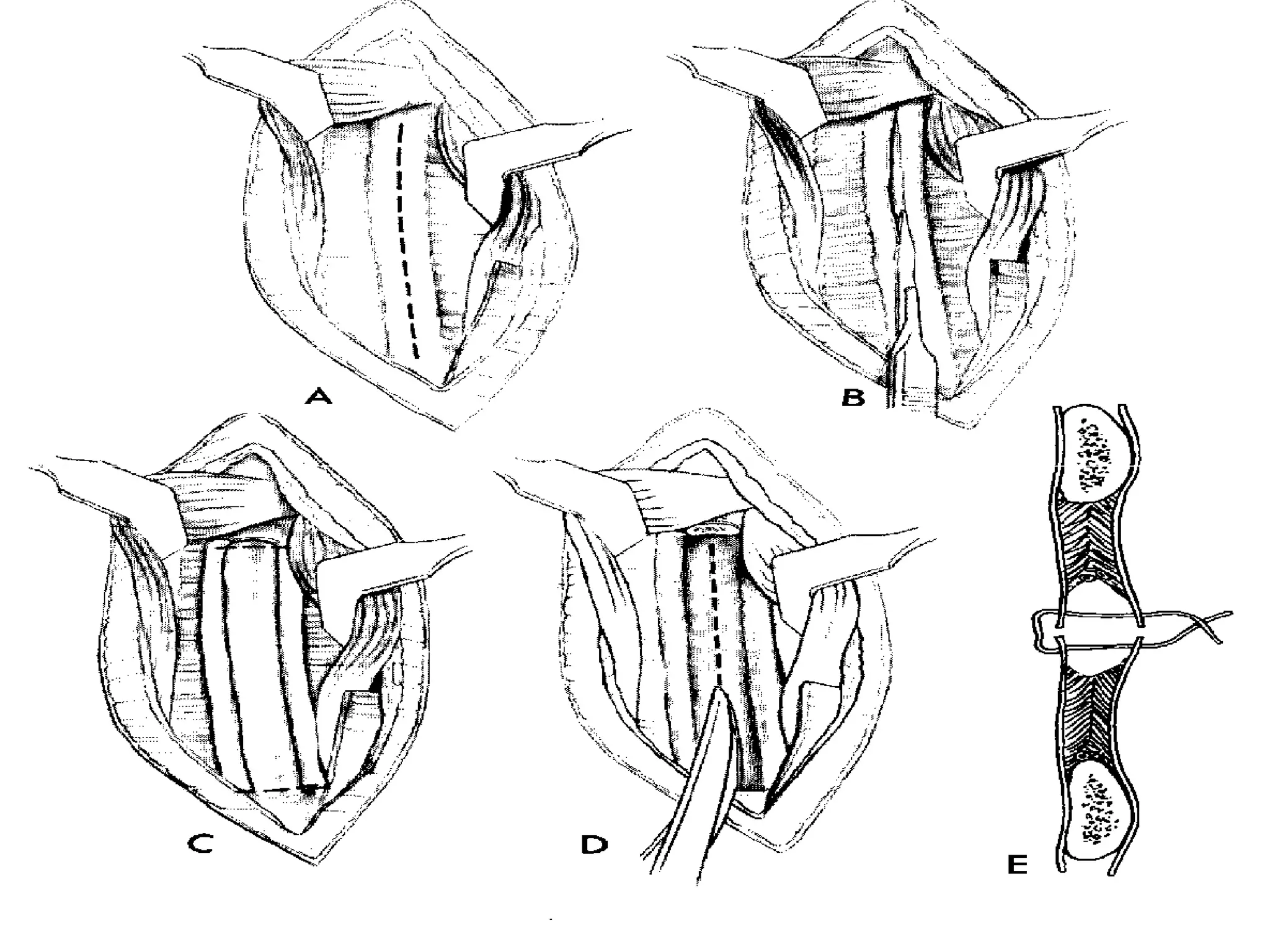 Surgical Approaches to thorax in small animals | PPTX