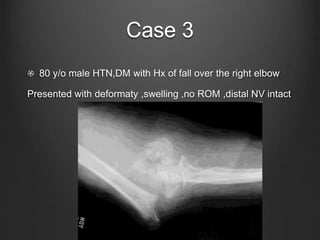 Approaches of elbow | PPTX | Death, Injury, or Military Conflict ...