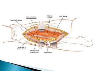 Approaches of femur | PPT