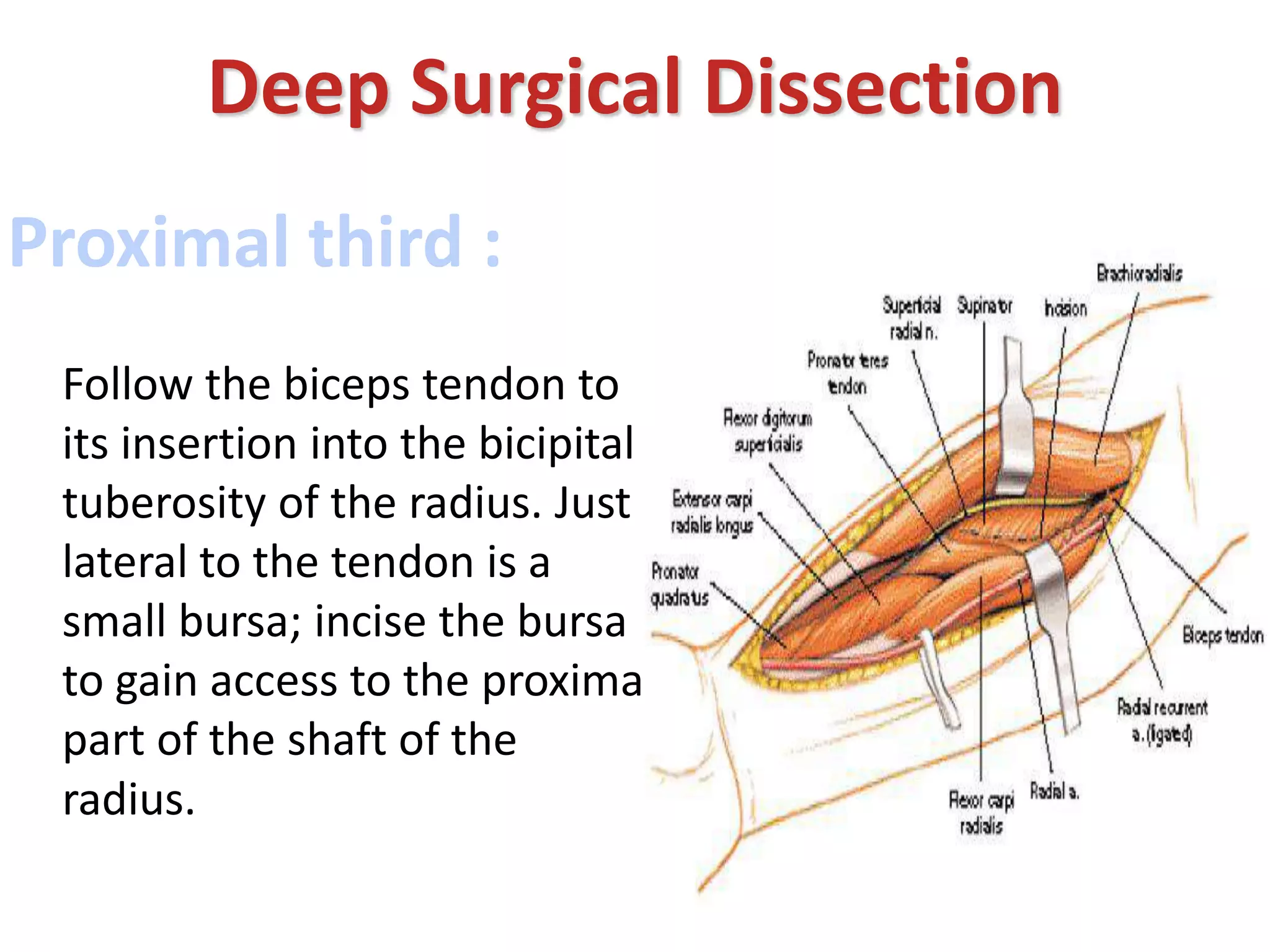 Approaches of forearm | PPT