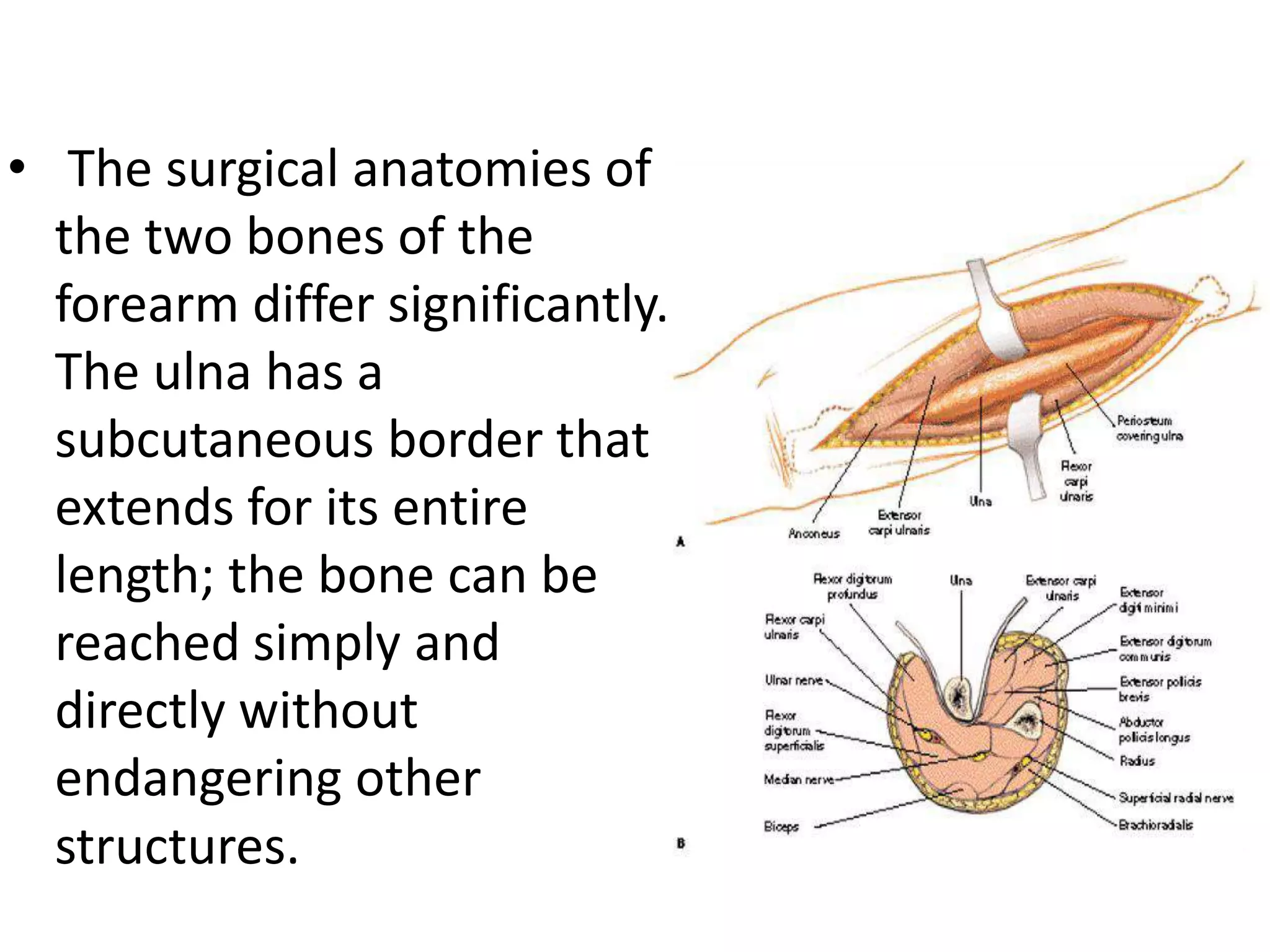 Approaches of forearm | PPT