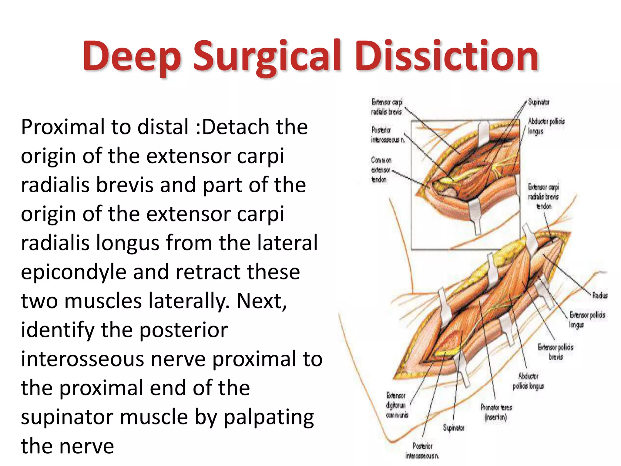 Approaches of forearm | PPT