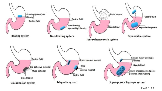 Approaches of GRDDS.pptx | Pharmaceutical Drugs | Medical Health