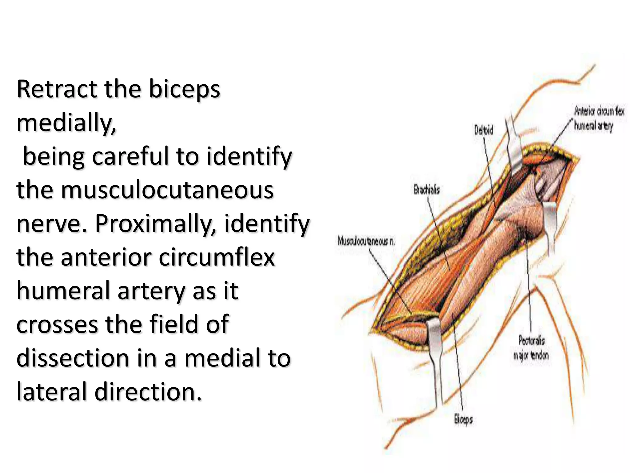 Approaches of humurus | PPT